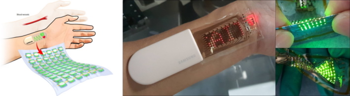 Samsung Creates Stretchable OLED Display For Monitoring Your Health ... Samsung Creates Stretchable OLED Display For Monitoring Your Health ...